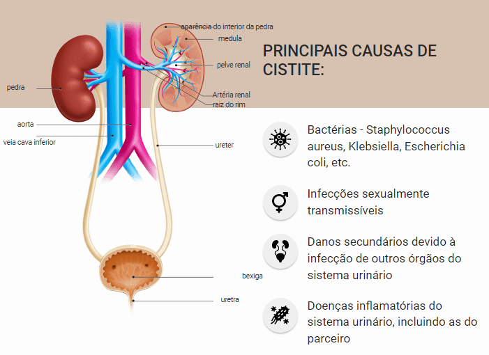 [INCONTINI] ADV Elimine a Cistite – Uromagazine